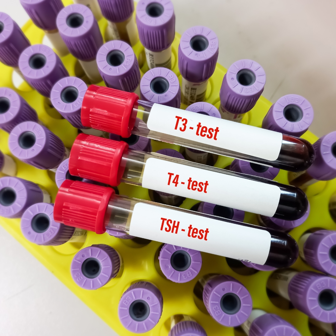 Thyroid Care Tea For Hypothyroidism - Vapika